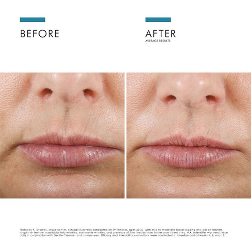 HA Intensifier by SkinCeuticals (30ml) – Flawless Body